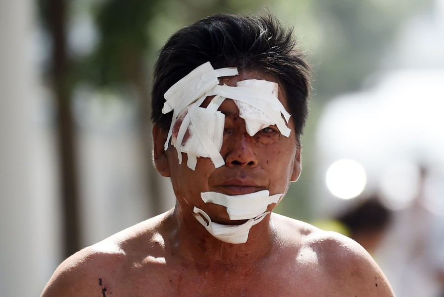 Photos of the Aftermath of the Massive Explosion in Tianjin, China ...