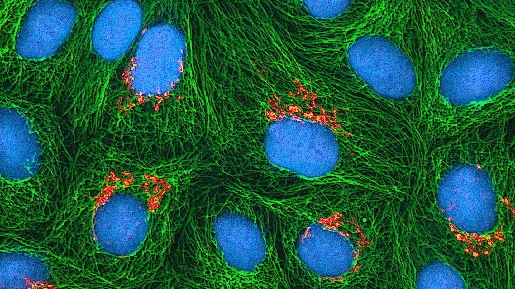Your Body Acquires Trillions of New Mutations Every Day - The Atlantic