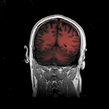 Emily Buder, The Atlantic