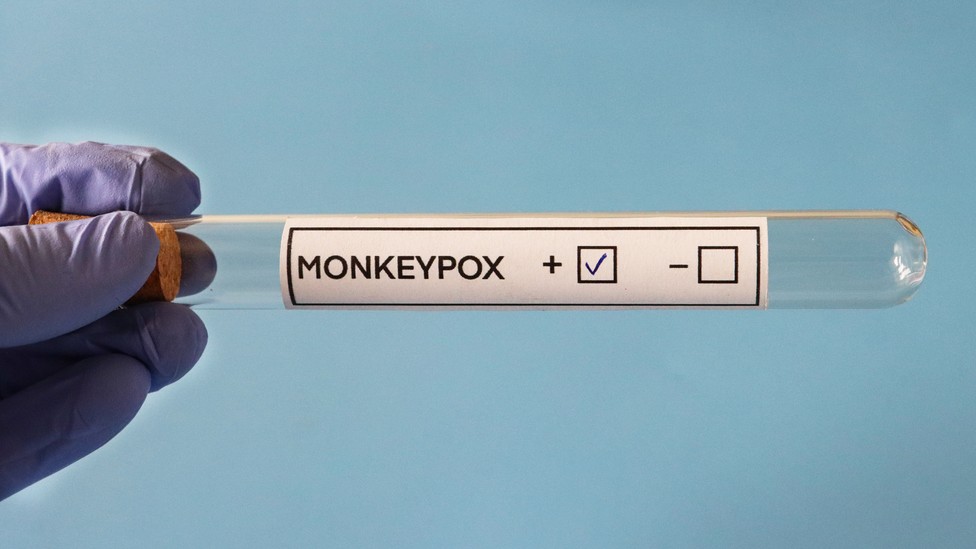 We’re Testing for Monkeypox the Wrong Way - The Atlantic