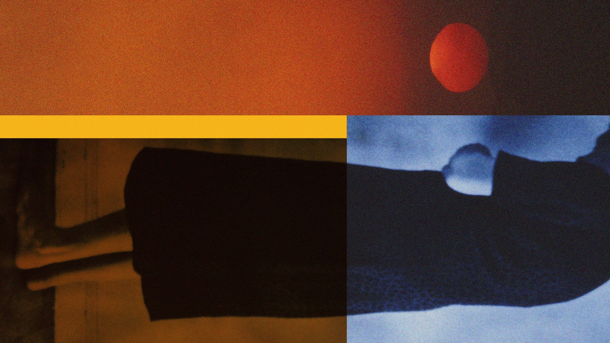 A Poem by Donald Platt: 'Explaining Pain' - The Atlantic