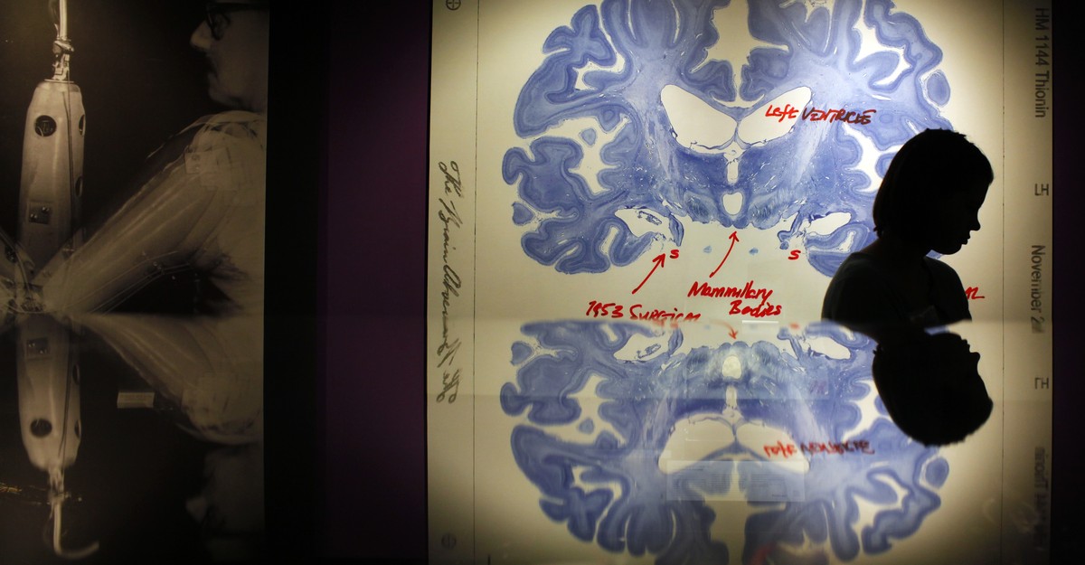 A Book About Neuroscience’s Most Famous Patient Sparks Controversy ...