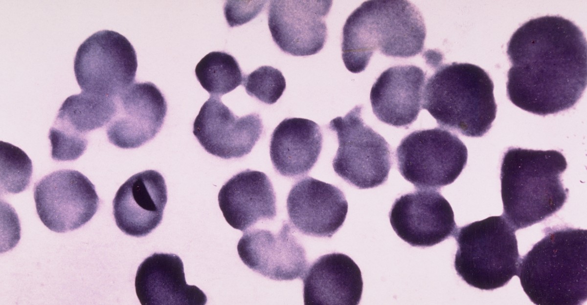 3 STDs Hit the Highest Number Ever Recorded in the U.S. - The Atlantic