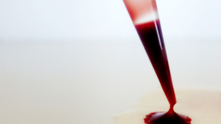 An Injection of Young Blood Improves Memory in Older Mice - The Atlantic