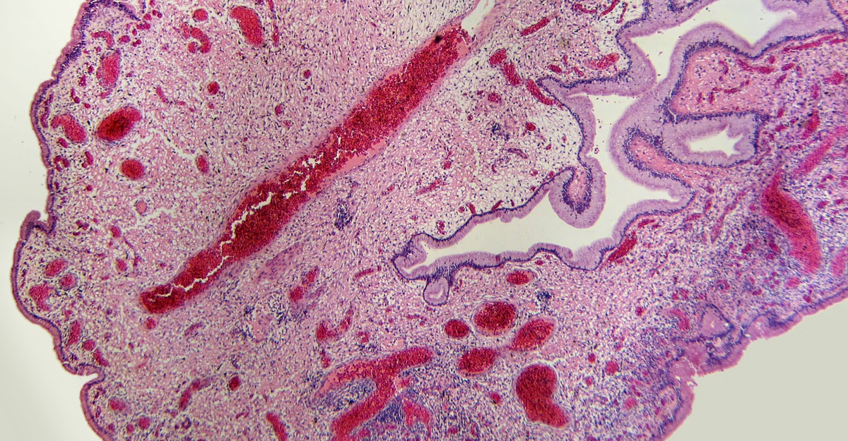 A Fitbit for Your Placenta - The Atlantic