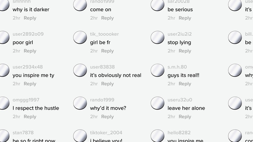 Tiktok S Scar Girl Is A Sign That The Internet Is Broken The Atlantic