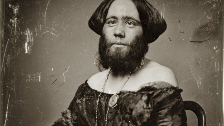 What the Bearded Lady Taught Us - The Atlantic