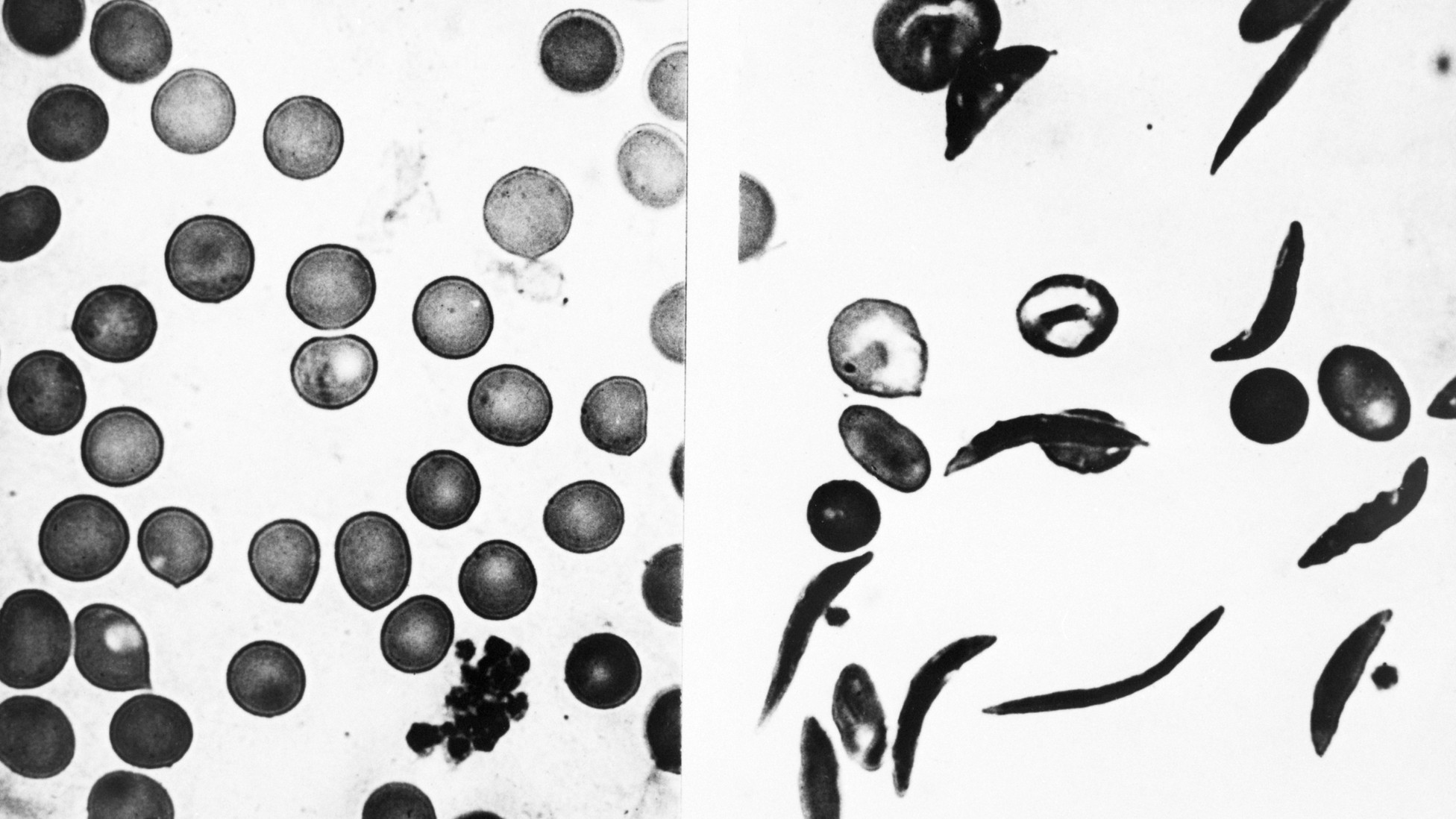 A Breakthrough in Gene Editing - The Atlantic