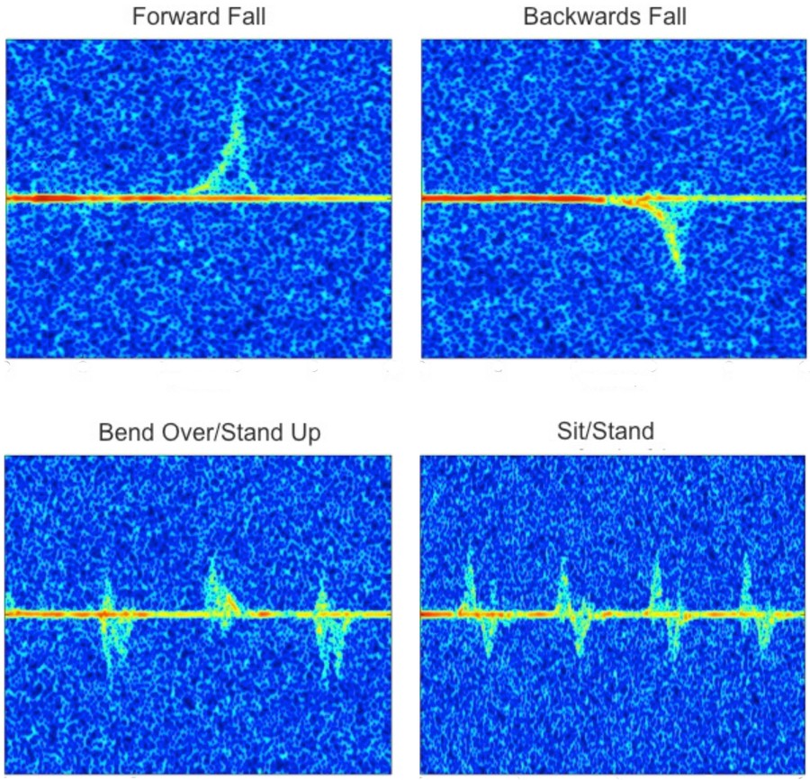 Who Will Watch You Fall? A Radar Detection Program for the Elderly ...