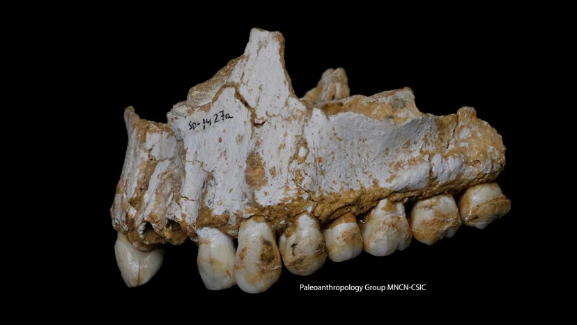 Mapping Human Migrations With Ancient Dental Plaque - The Atlantic