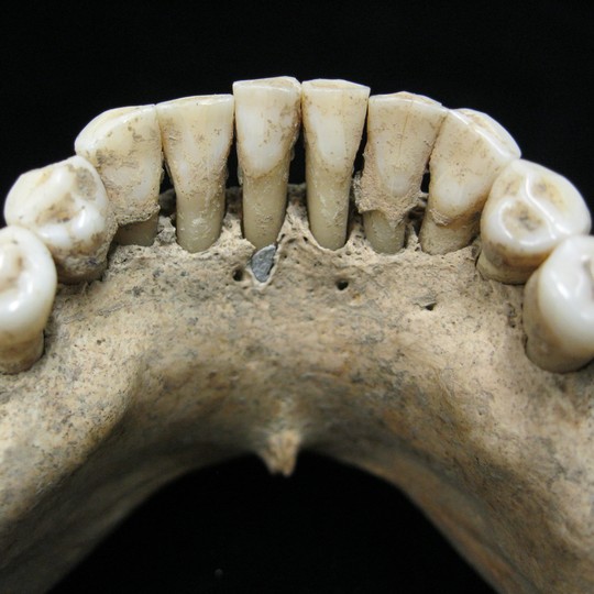 The Woman With Lapis Lazuli in Her Teeth The Atlantic