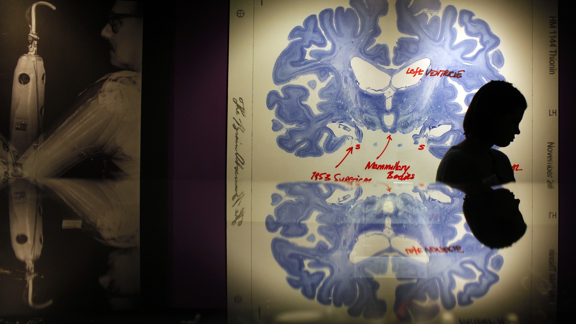 A Book About Neuroscience’s Most Famous Patient Sparks Controversy ...