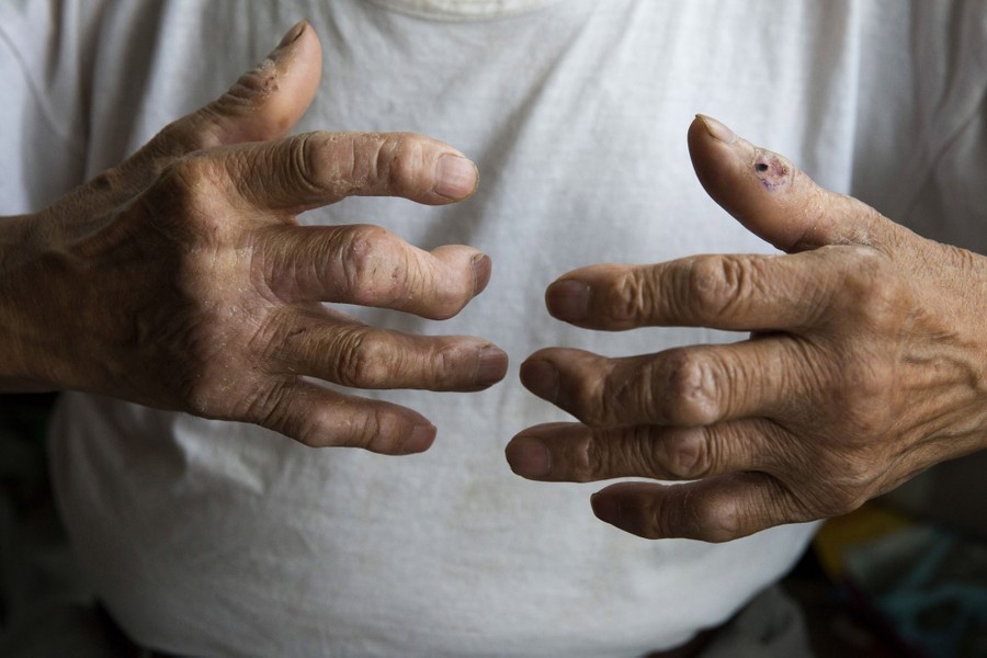 Remembering China's Forgotten WWII Veterans - The Atlantic